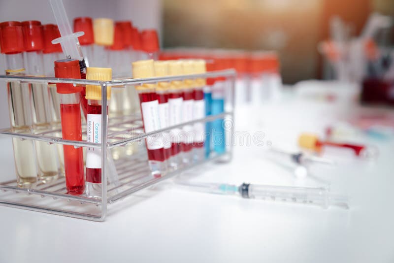 Blood Samples in Tubes and Syringes on Work Table in a Medical ...