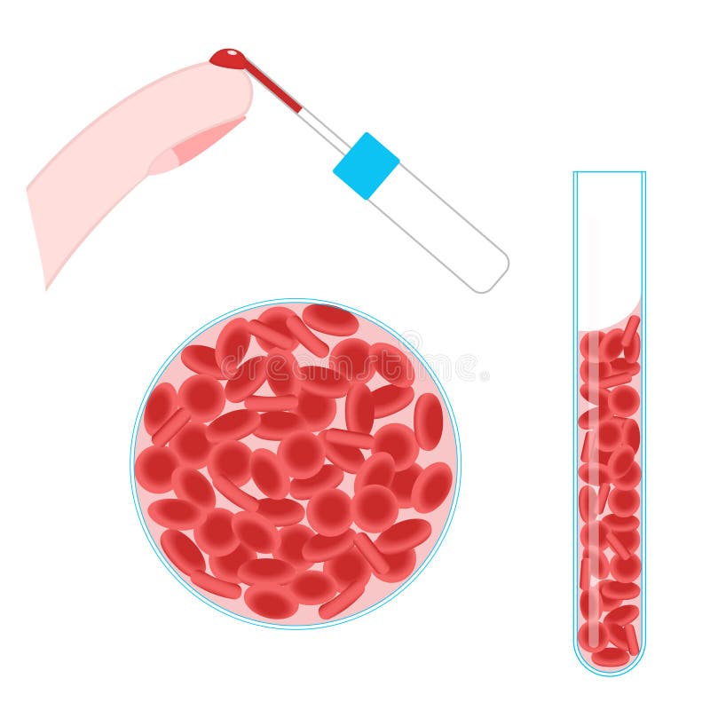 Blood Sampling from a Finger for Analysis Stock Vector - Illustration ...