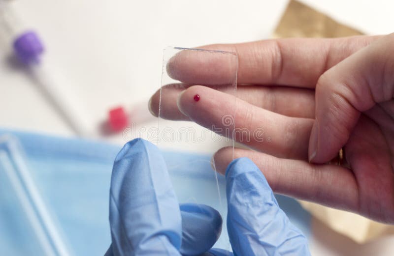Blood Sampling from the Finger, Close-up, Hand, Blood Finger Stock ...