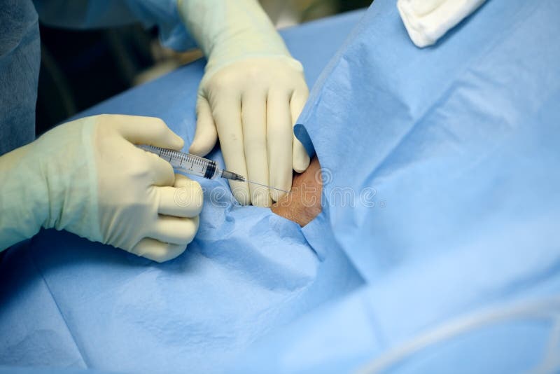 Preparation For Blood Sampling In Clinic Stock Image - Image of latex ...