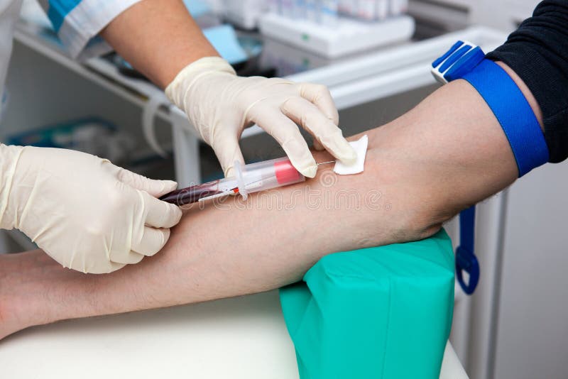 Blood Sampling Procedure for Analysis Stock Photo - Image of ...