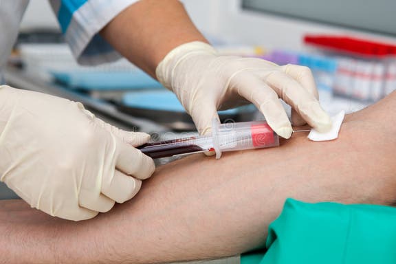 Blood Sampling Procedure for Analysis Stock Image - Image of needle ...