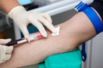 Blood Sampling Procedure for Analysis Stock Photo - Image of clinic ...
