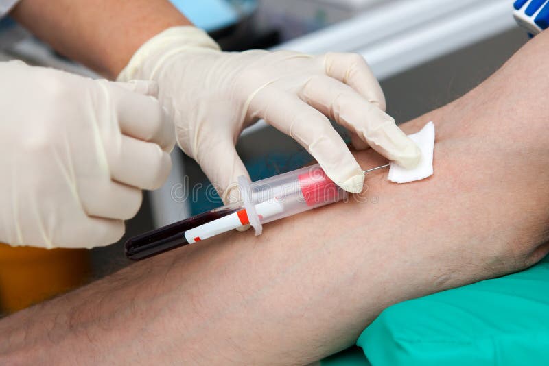 Blood Sampling Procedure for Analysis Stock Image - Image of needle ...