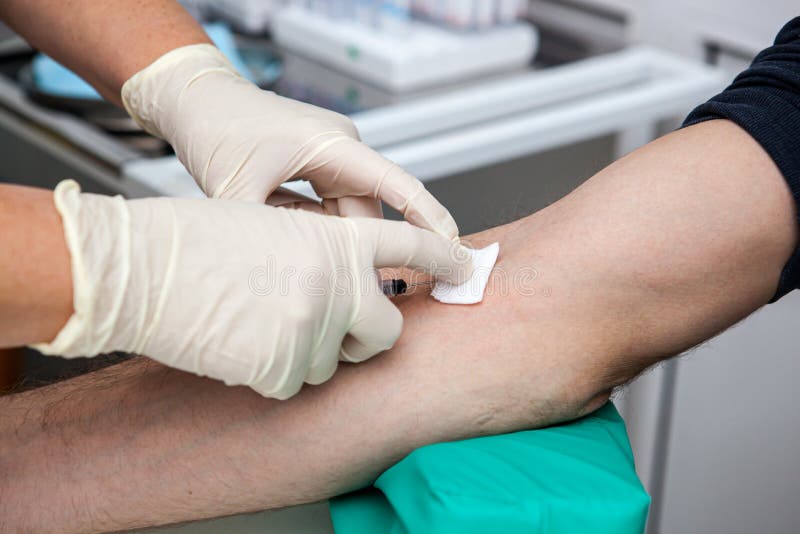 Blood Sampling Procedure for Analysis Stock Photo - Image of plasma ...
