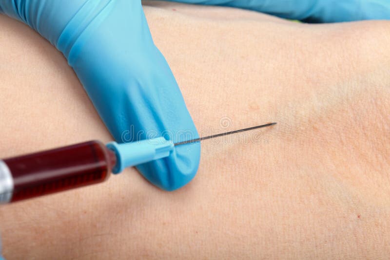 Sampling Of Blood From The Cows Stock Image - Image of experiment, farm ...