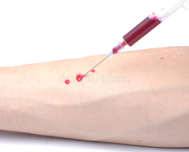 Blood Sampling with Syringe Stock Image - Image of macro, sample: 48662709