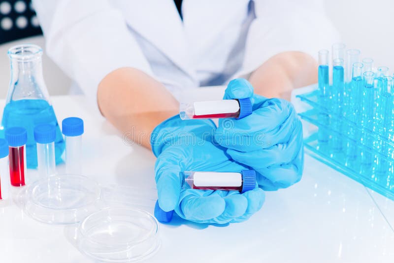 Blood Sampling, Blood Test, Blood Infection Test. Research of New ...