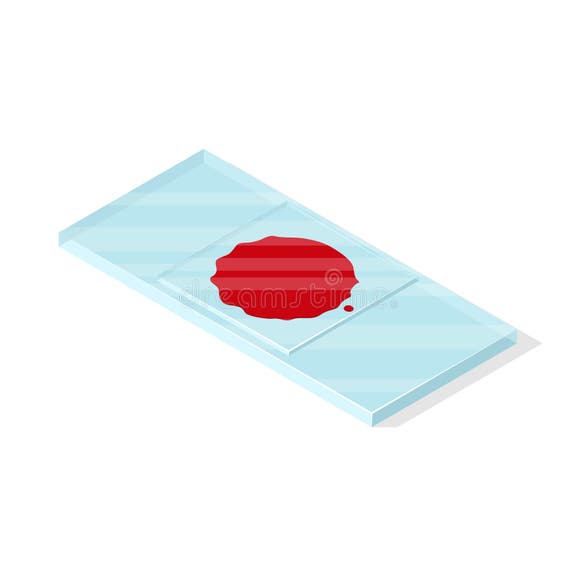 Blood on slide. stock vector. Illustration of hematology - 96625452