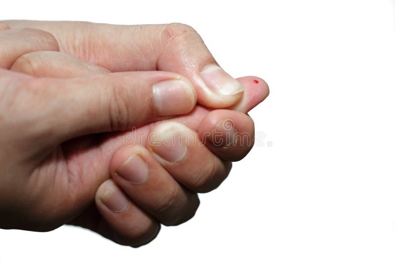 Blood stain on finger. stock photo. Image of disease - 35265174