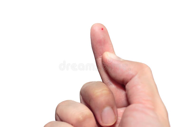 Blood stain on finger. stock photo. Image of leak, blood - 35265214