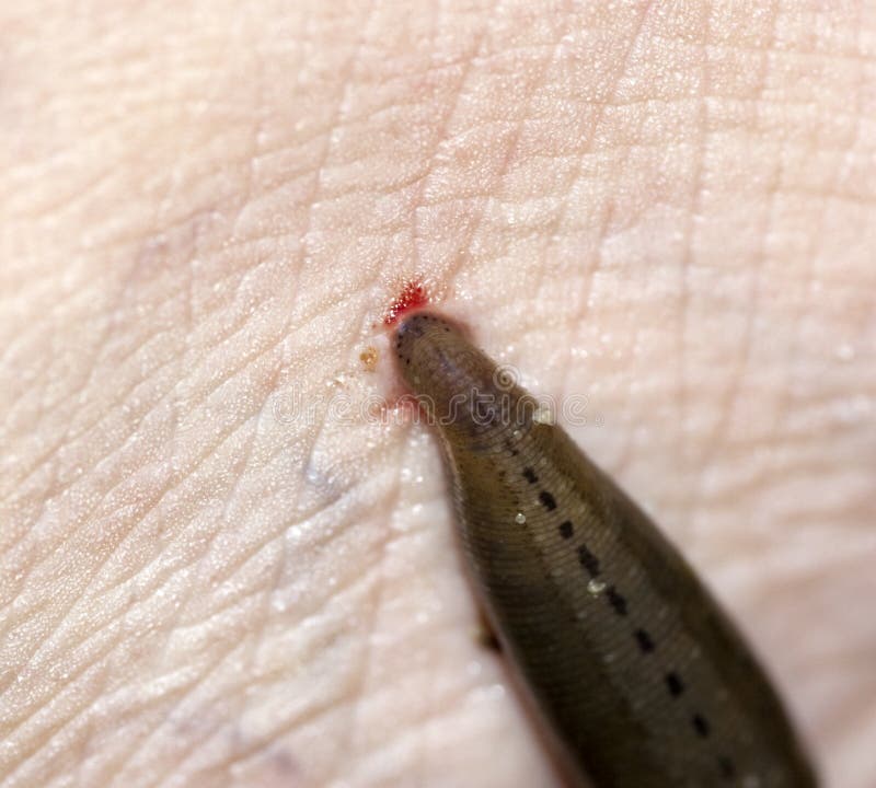 Blood sucking leech stock image. Image of biting, macro - 11643883