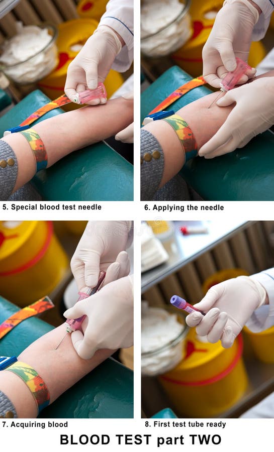 Blood test machine stock image. Image of revolve, rotate - 14015961