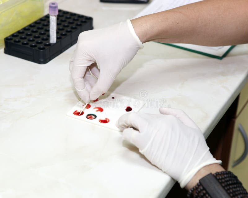 Blood Test stock image. Image of lancet, experiment, bleed - 19660723