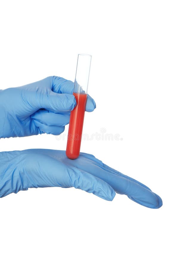 Blood test stock photo. Image of forensic, illness, biochemistry - 27110410