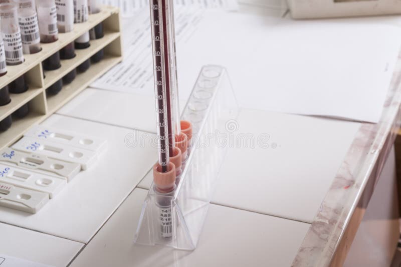 Blood test stock photo. Image of examination, diagnosis - 46229794