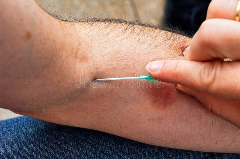 Blood test stock photo. Image of blood, health, test - 219828090