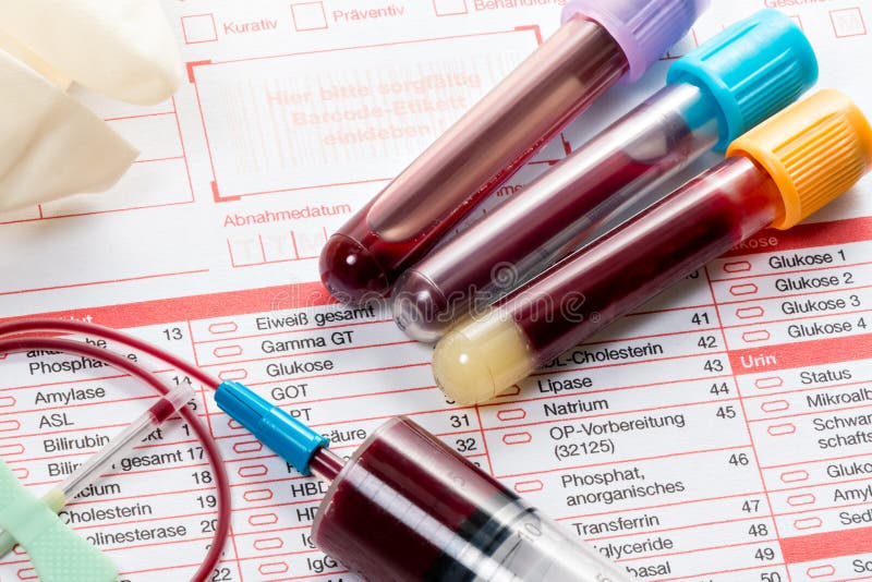 Blood Test, Blood Samples on a Laboratory Form Stock Photo - Image of ...