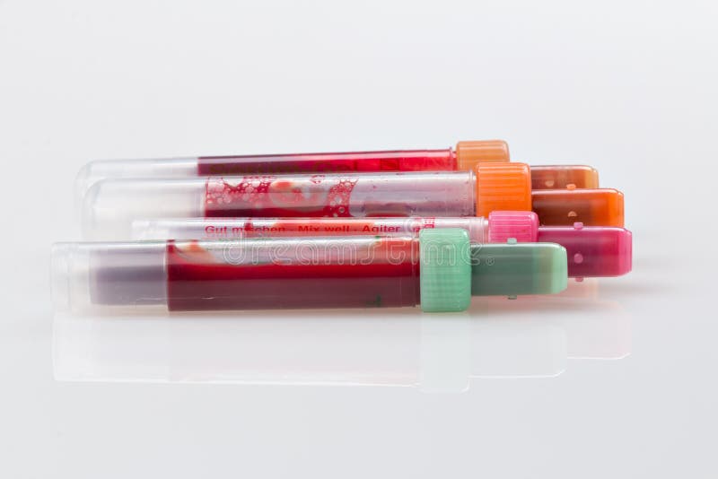 Blood Test, Blood Samples on a Laboratory Form Stock Image - Image of ...