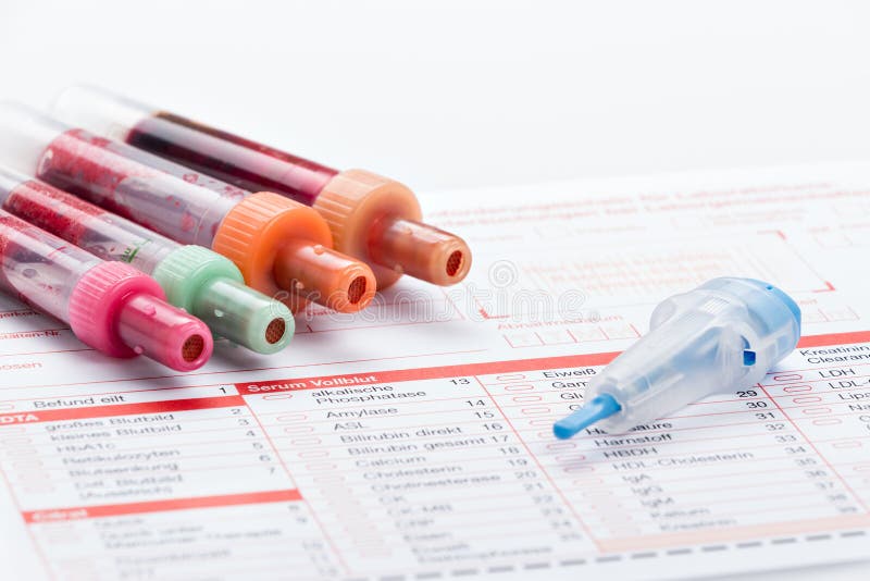 Blood Test, Blood Samples on a Laboratory Form Stock Photo - Image of ...