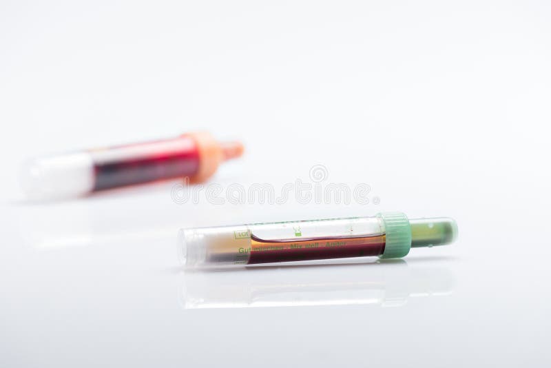 Blood Test, Blood Samples on a Laboratory Form Stock Image - Image of ...