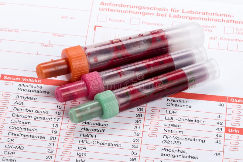 Blood Test, Blood Samples on a Laboratory Form Stock Photo - Image of ...