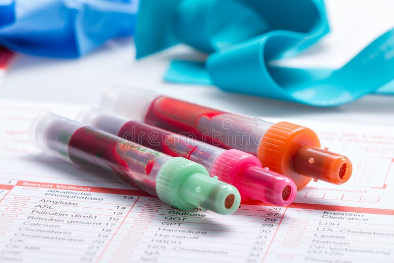 Blood Test, Blood Samples on a Laboratory Form Stock Photo - Image of ...