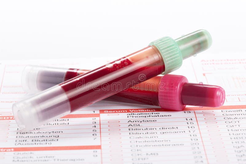 Blood Test, Blood Samples on a Laboratory Form Stock Image - Image of ...