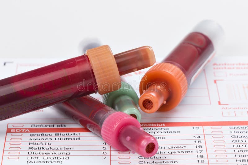 Blood Test, Blood Samples on a Laboratory Form Stock Image - Image of ...