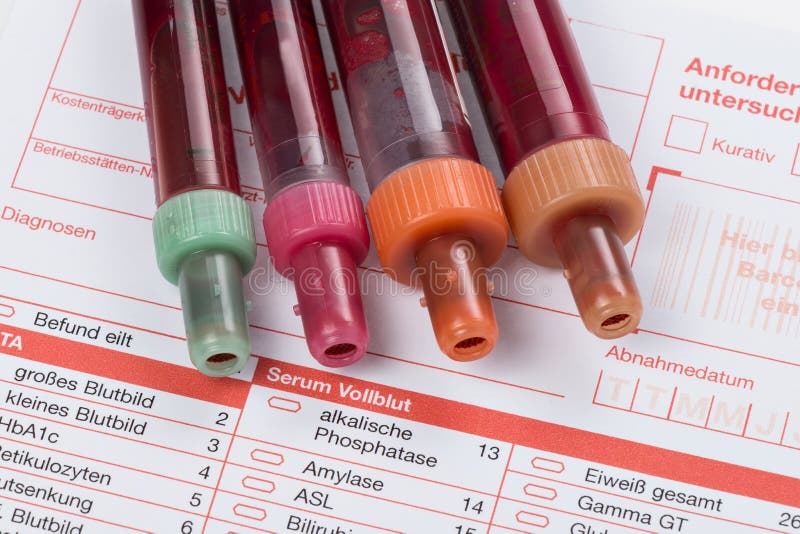 Blood Test, Blood Samples on a Laboratory Form Stock Photo - Image of ...