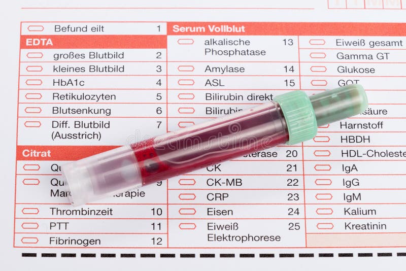 Blood Test, Blood Samples on a Laboratory Form Stock Image - Image of ...