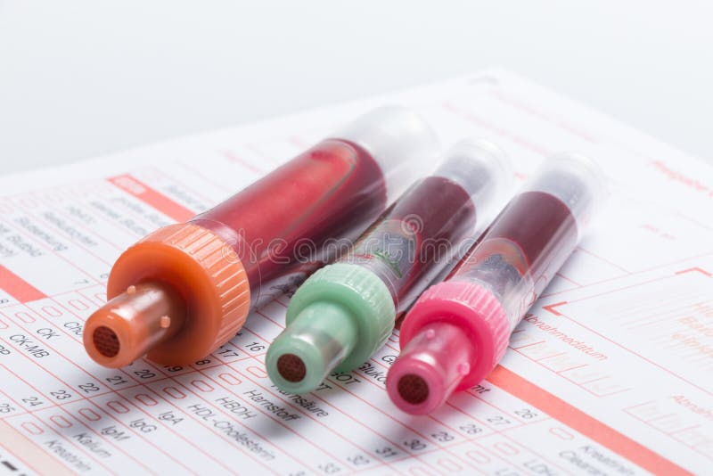 Blood Test, Blood Samples on a Laboratory Form Stock Image - Image of ...