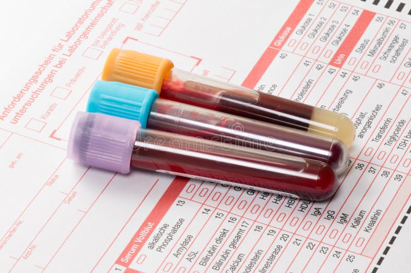 Blood Test, Blood Samples on a Laboratory Form Stock Photo - Image of ...