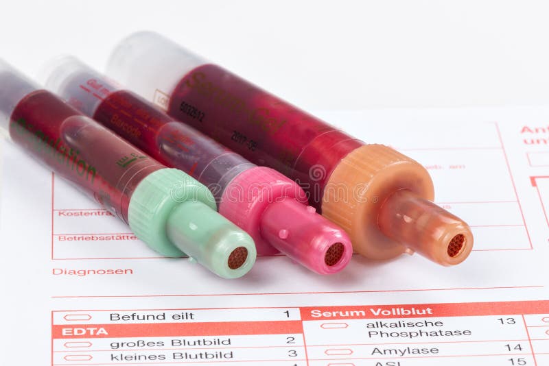 Blood Test, Blood Samples on a Laboratory Form Stock Photo - Image of ...