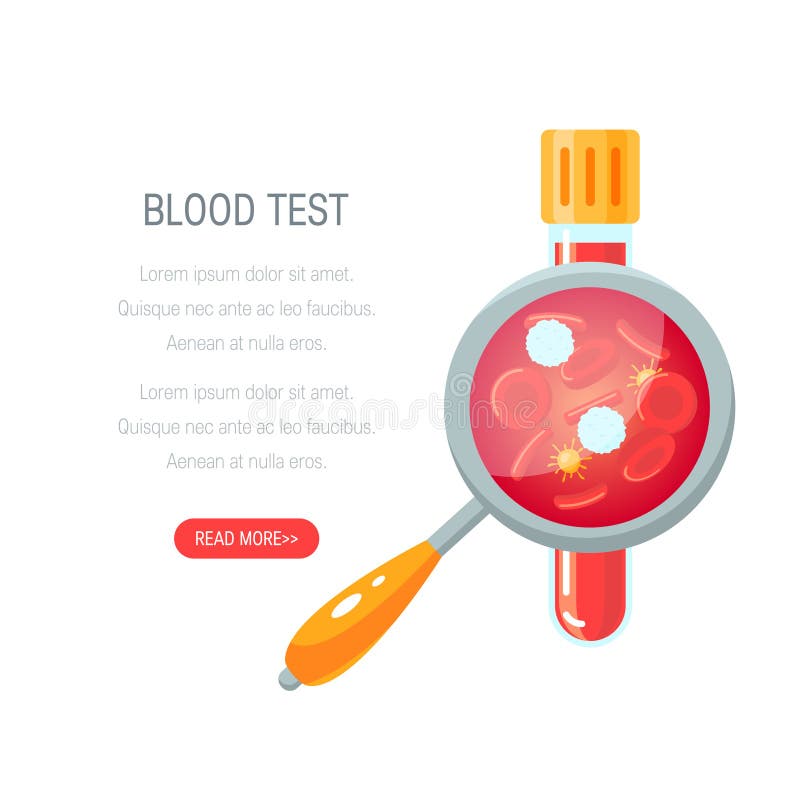 Blood Test Concept, Vector Design in Flat Style Stock Vector ...