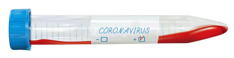 Blood Test on Coronavirus in Microbiological Tube Stock Vector ...