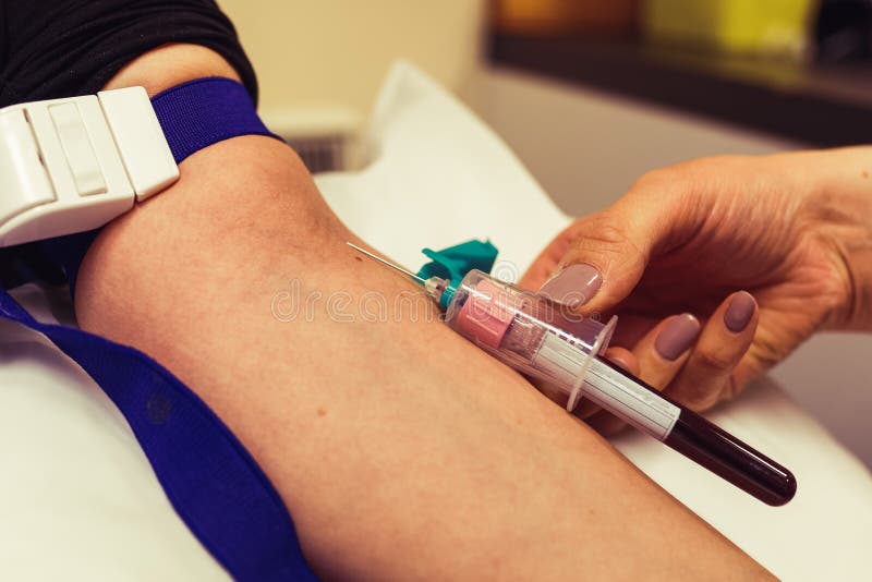 Blood test stock image. Image of blood, human, adult - 83037755