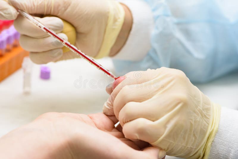 Blood Test from Finger stock image. Image of test, drop - 137599533