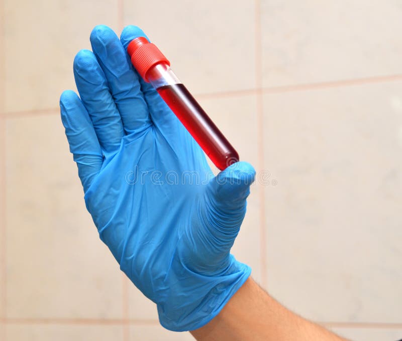 Blood Test - a Hand with a Test Tube Stock Photo - Image of experiment ...