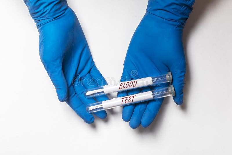 Blood Test in Lab Tubes in Doctor Hands Close Up Stock Photo - Image of ...