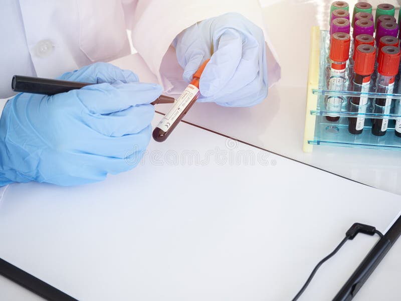 Blood Test in the Laboratory. Laboratory Assistant Working with the ...