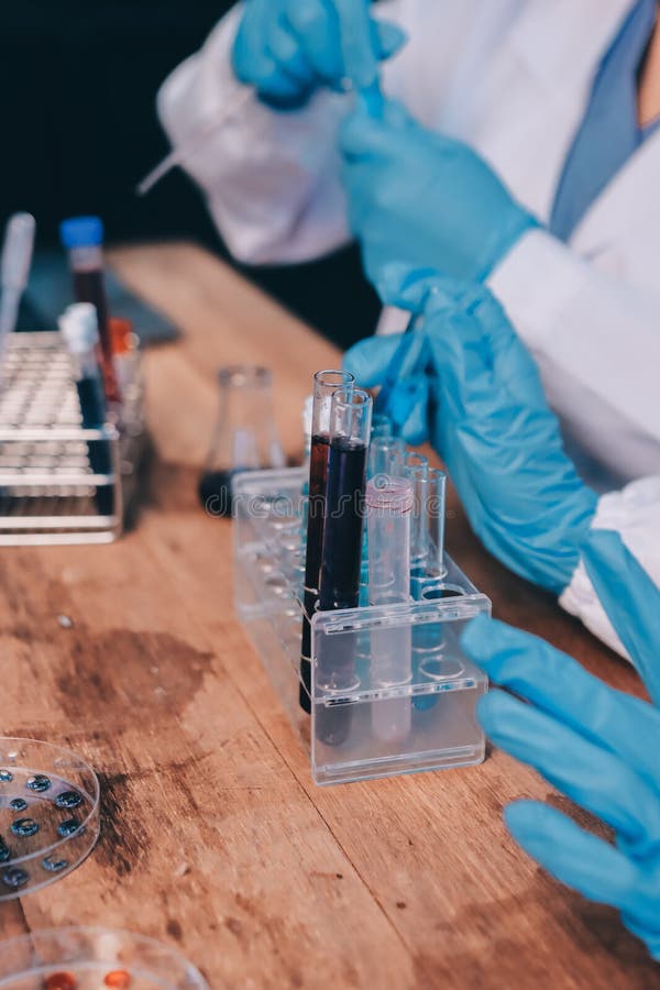 Blood Test in the Laboratory. Laboratory Assistant Working with the ...