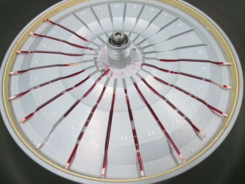 Blood test machine stock photo. Image of specialised - 14016112