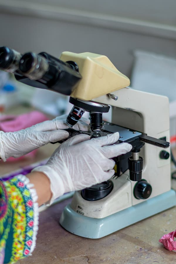 Blood Test in Medical Lab editorial stock photo. Image of chemistry ...
