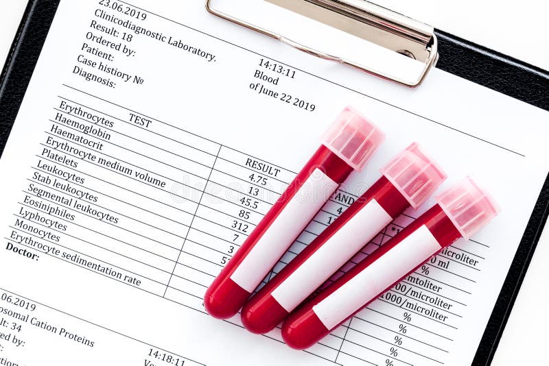 Blood Test Results on White Background Top View Stock Image - Image of ...