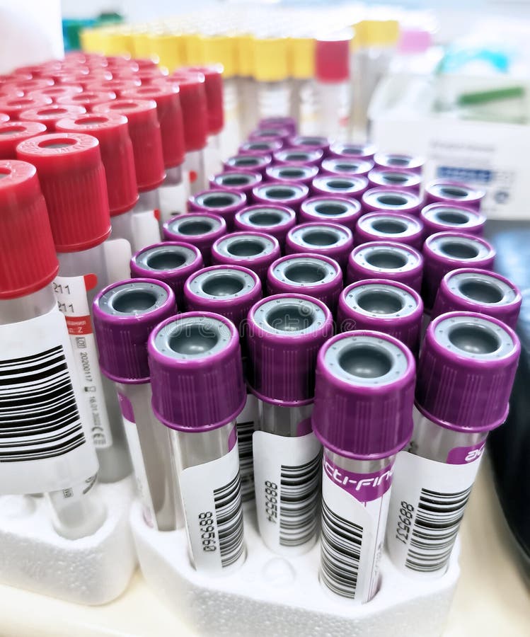 Blood Test Room. Taking Blood Editorial Photo - Image of cure, medical ...