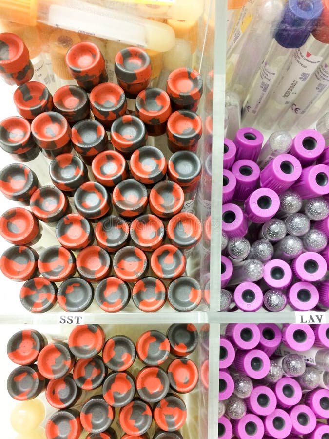 Blood test sample vials stock photo. Image of experiment - 183040202