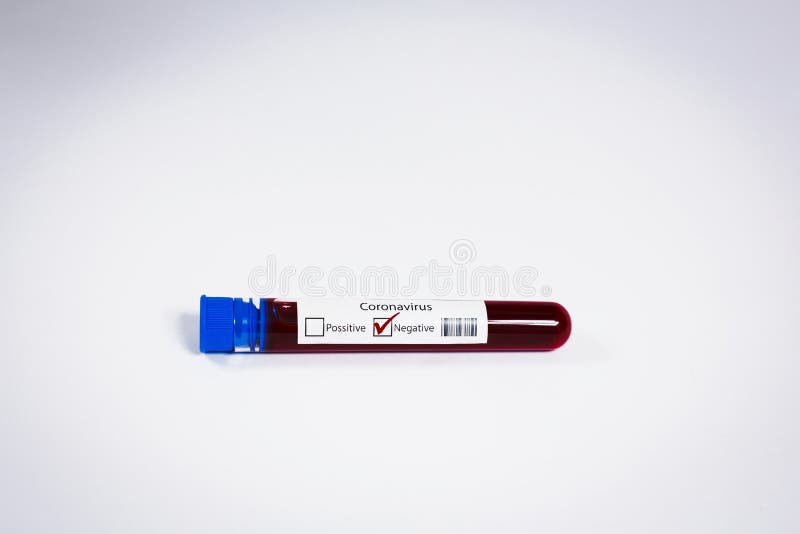 Blood Test Samples for Presence of Coronavirus COVID-19 Tube Containing ...