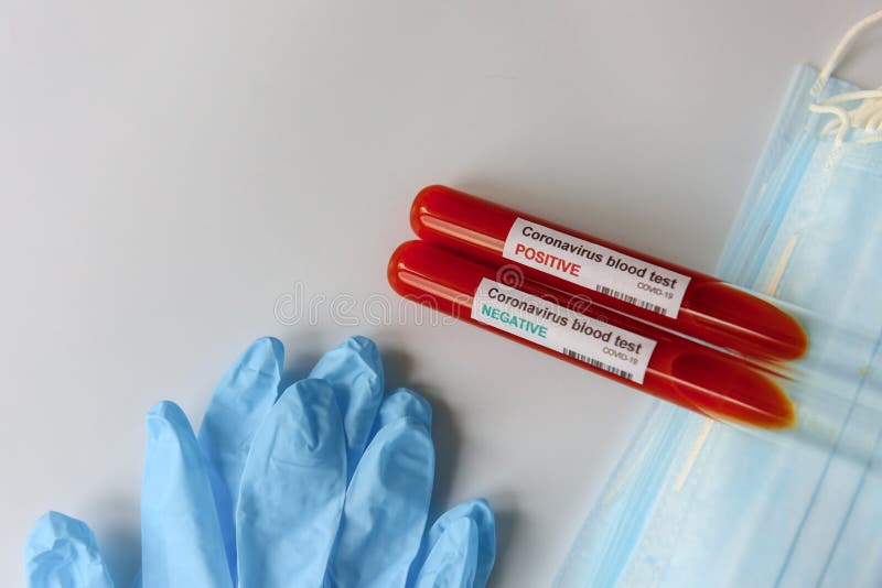 Blood Test Samples for Presence of Virus COVID-19, Tubes Containing a ...