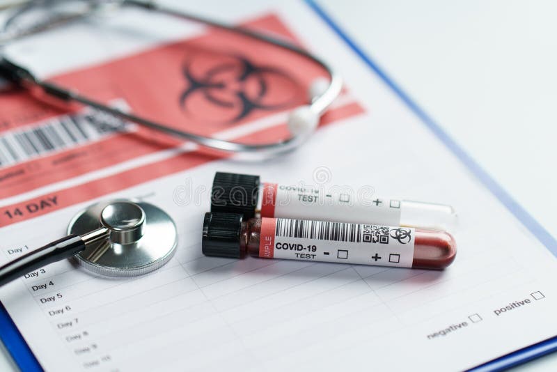 Blood Test Samples Tube and Swab Collection Kit in the Laboratory ...
